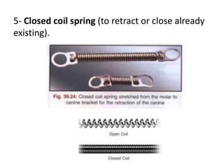 Auxiliary attachment | PPTX