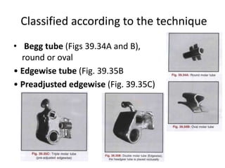 Auxiliary attachment | PPTX