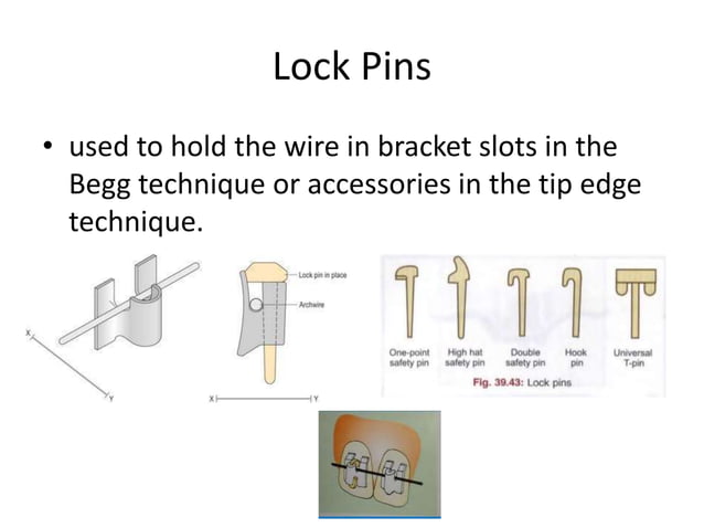 Auxiliary attachment | PPTX | Oral care | Personal Care