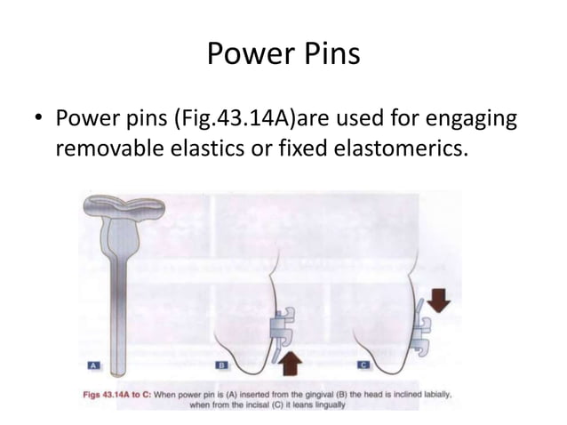 Auxiliary attachment | PPTX | Oral care | Personal Care