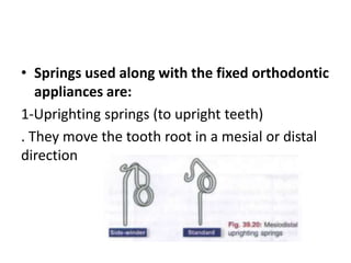 Auxiliary attachment | PPTX