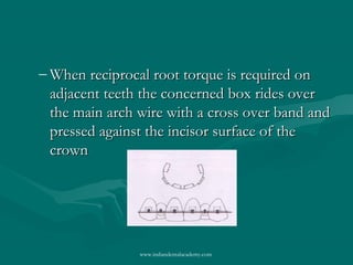 Auxilleries /certified fixed orthodontic courses by Indian dental ...