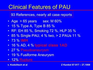 Aortic ulcer intramural hematoma aortic dissection | PPT