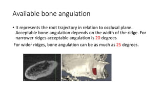 Available bonffffffffffffffffffffffffffffffe.pptx