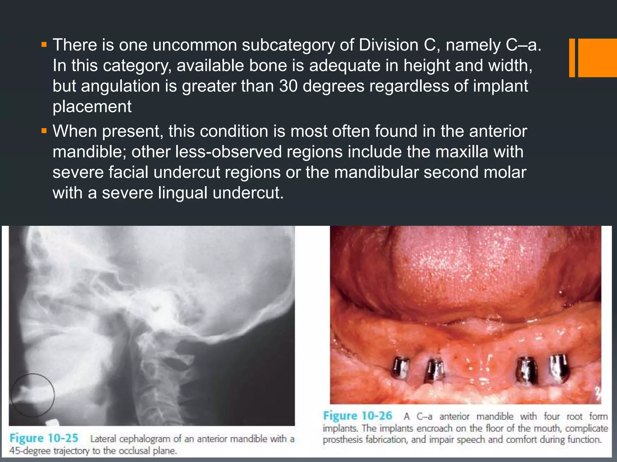 Available Bone and Dental Implant Treatment Plans.pptx