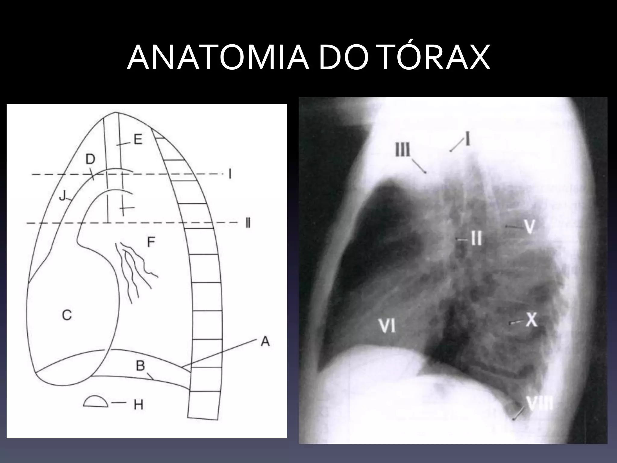 Avaliação sistemática da radiografia do tórax | PPT