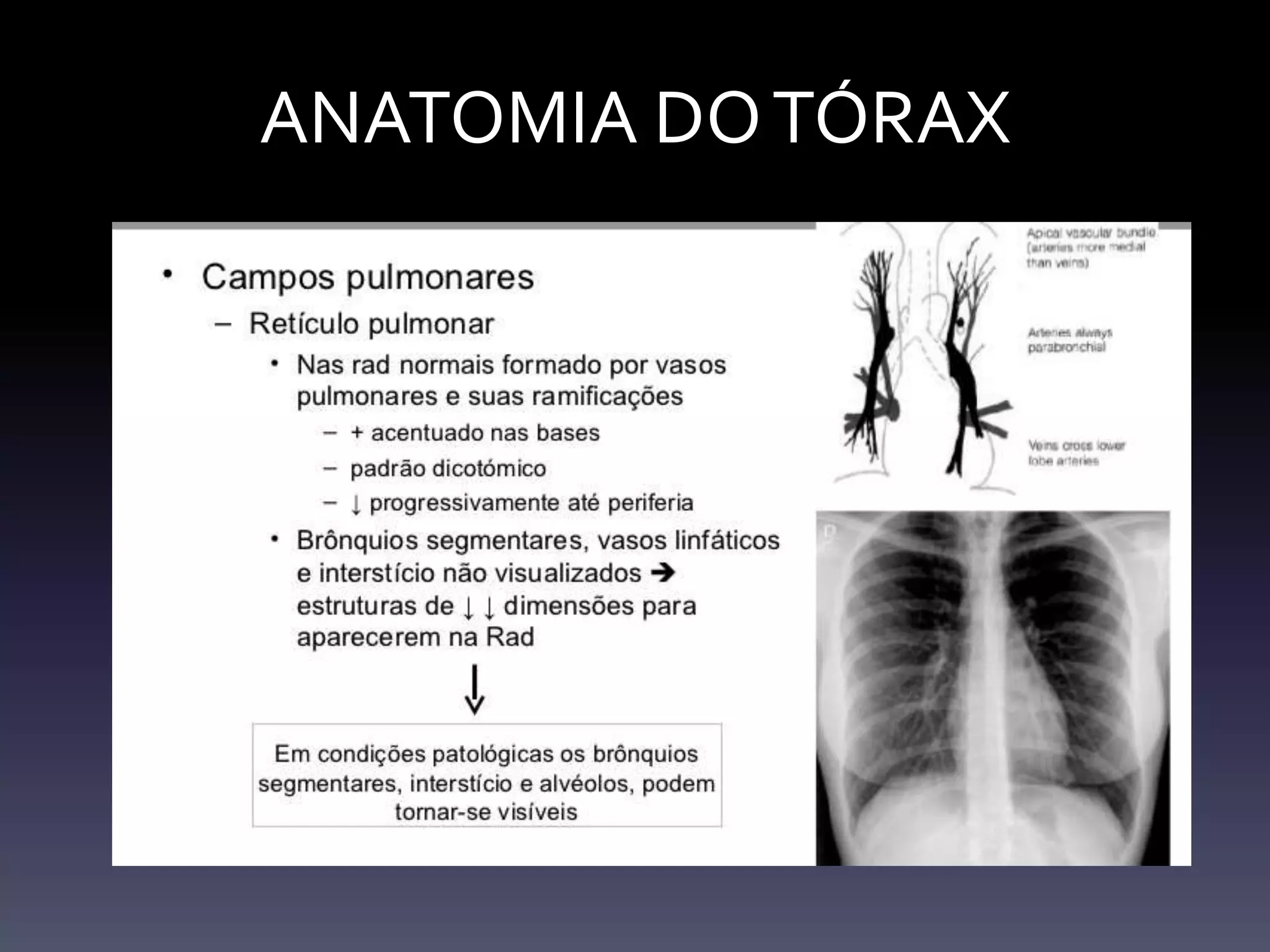 Avaliação sistemática da radiografia do tórax | PPT