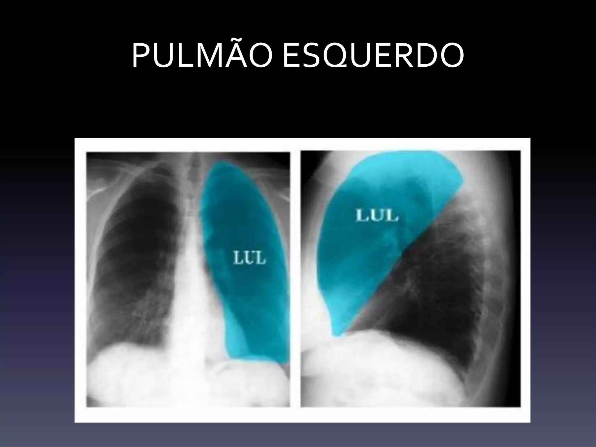 Avaliação sistemática da radiografia do tórax | PPT