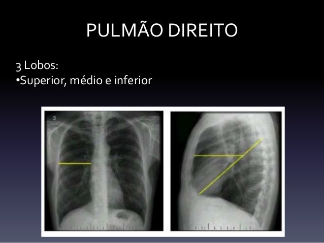 Avaliação sistemática da radiografia do tórax
