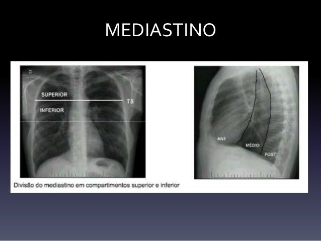 Avaliação sistemática da radiografia do tórax