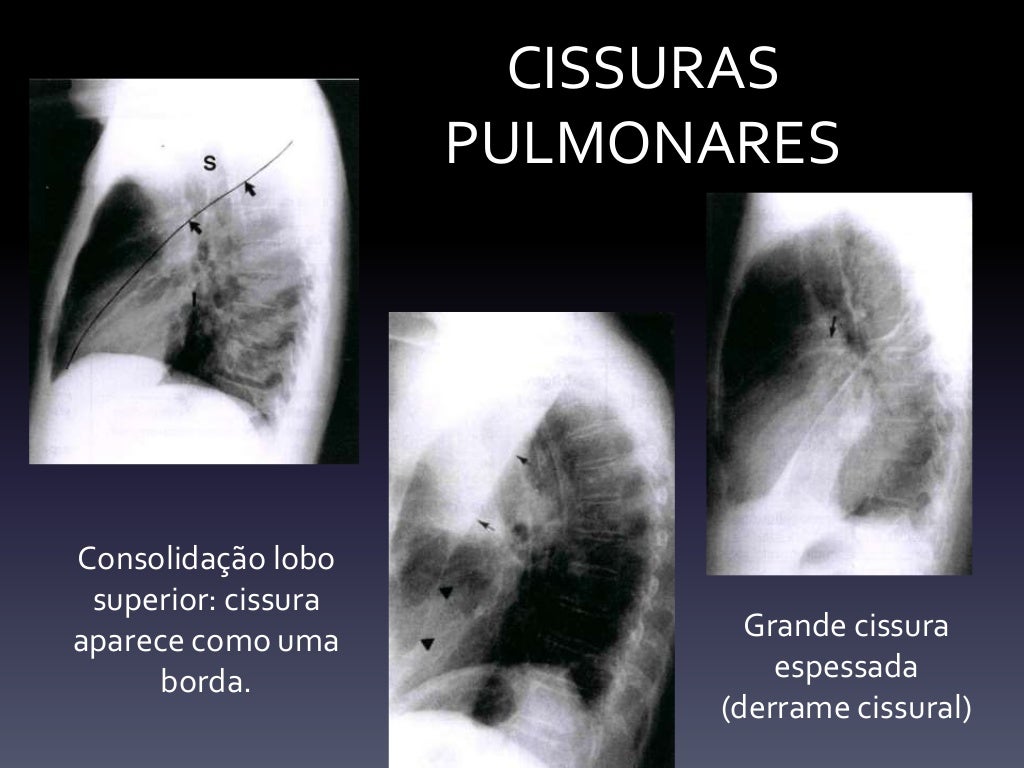 Avaliação sistemática da radiografia do tórax
