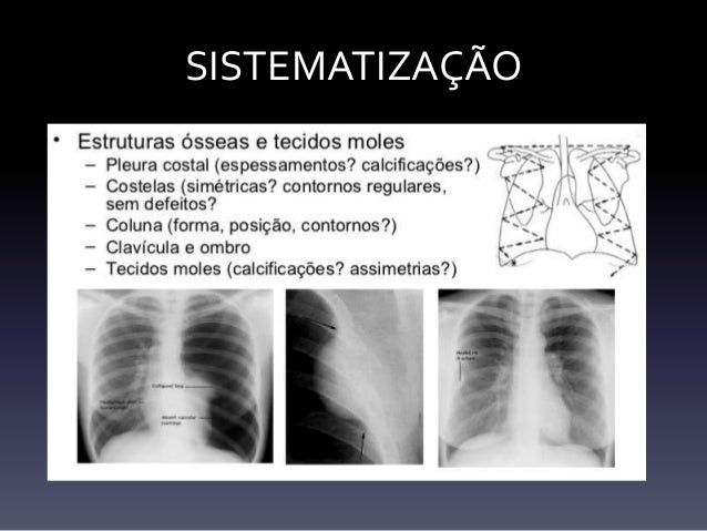 Avaliação sistemática da radiografia do tórax