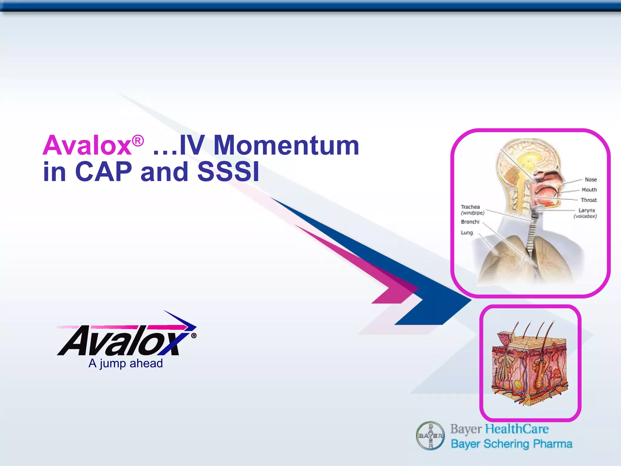 Avalox iv cap&sss is 1 | PPT