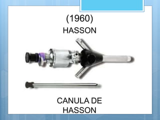 Avances en cirugia laparoscopica | PPTX