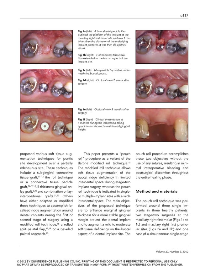 A Variation of the Modified Roll Technique.pdf | Oral care | Personal Care