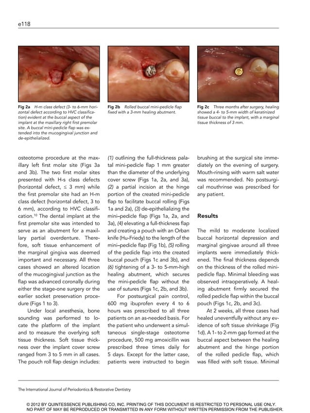 A Variation of the Modified Roll Technique.pdf | Oral care | Personal Care