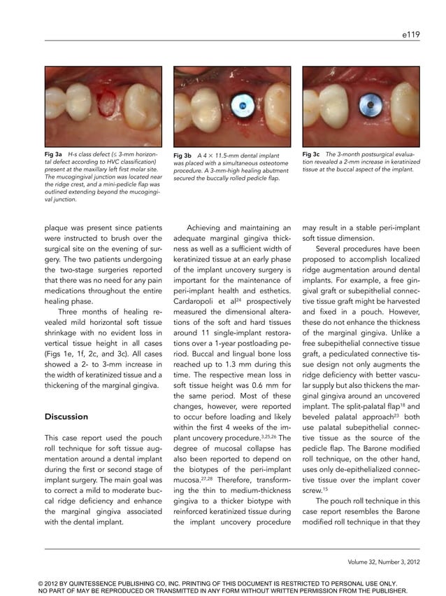 A Variation of the Modified Roll Technique.pdf | Oral care | Personal Care