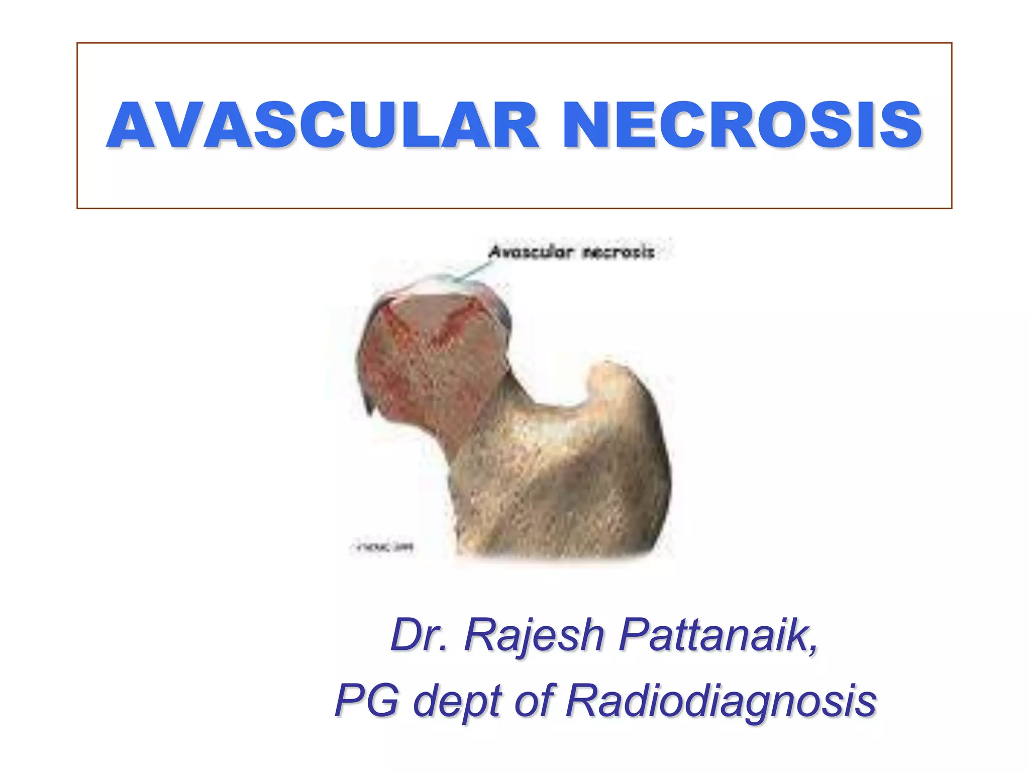 Avascular necrosis Radiology | PPTX