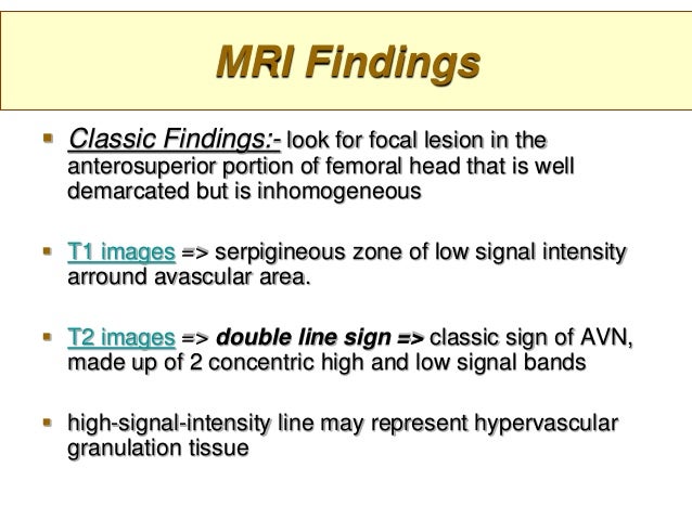 Avascular necrosis Radiology