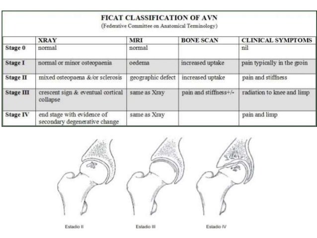 Avascular necrosis Radiology
