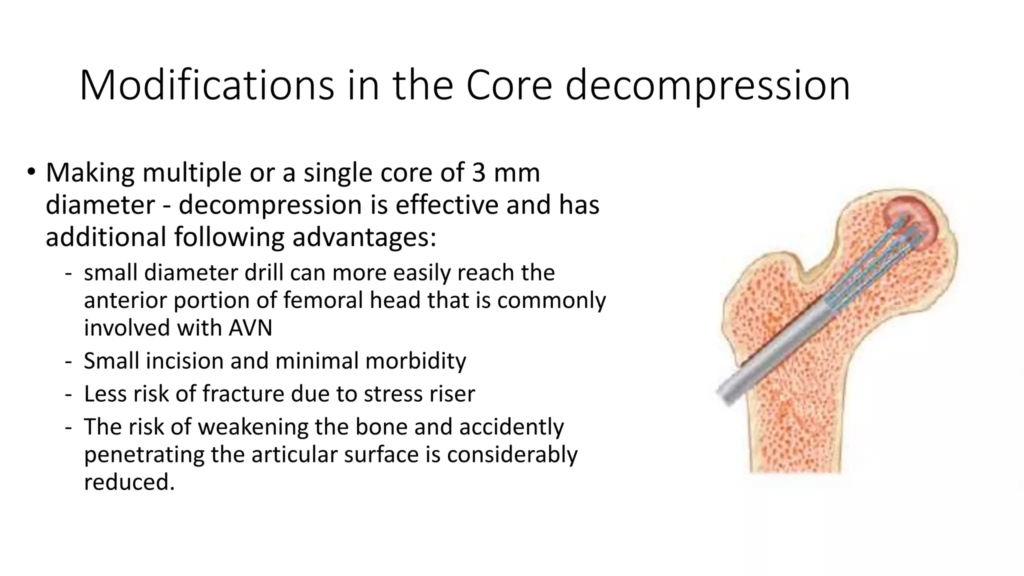 Avascular necrosis of Hip - treatment modalities and current concepts.pptx