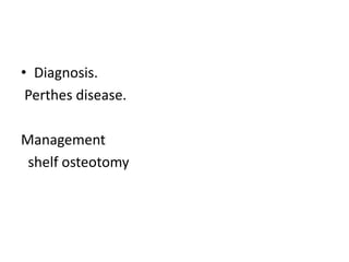 Avascular Necrosis Of Femoral Head.pptx