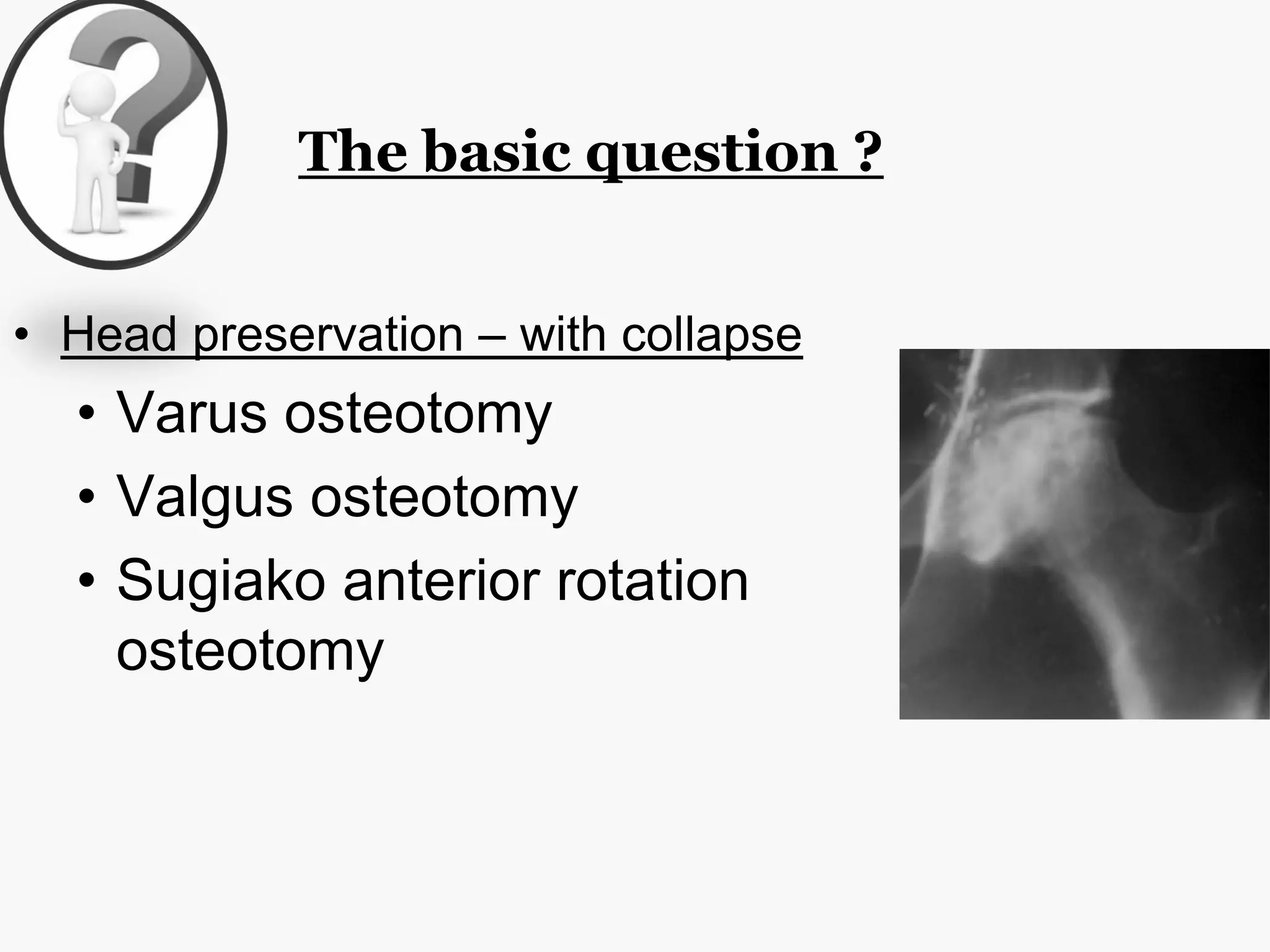 Avascular necrosis of hip | PDF