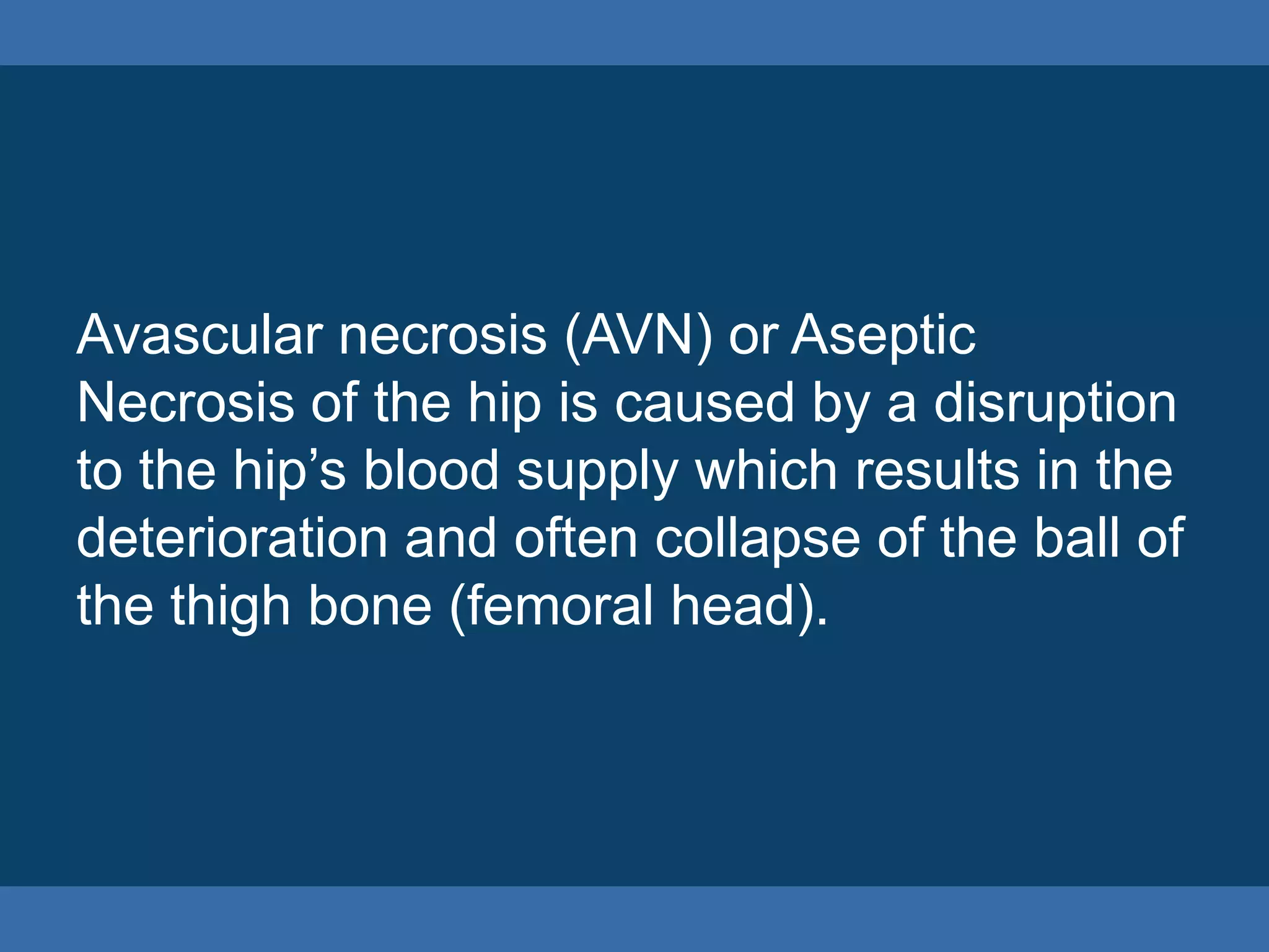 Avascular Necrosis of the Hip | PPTX