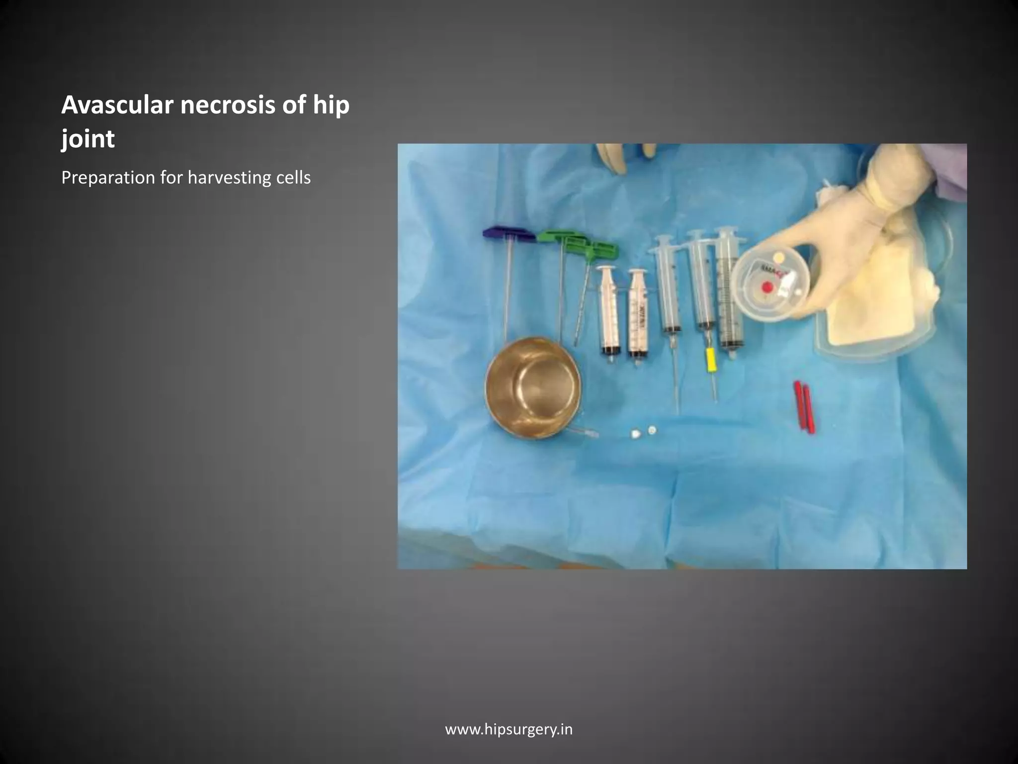 Avascular necrosis of hip joint | PPTX