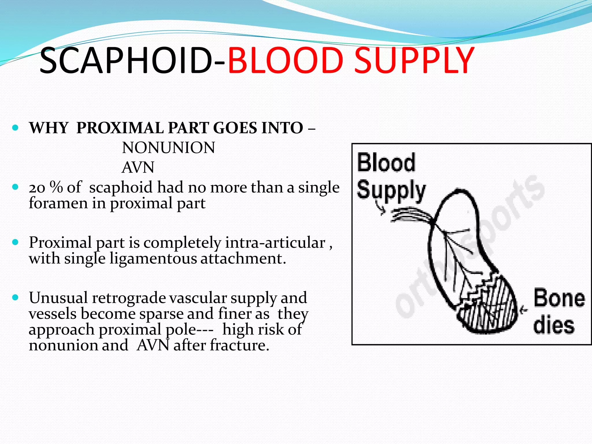 Avascular necrosis of scaphoid | PPTX