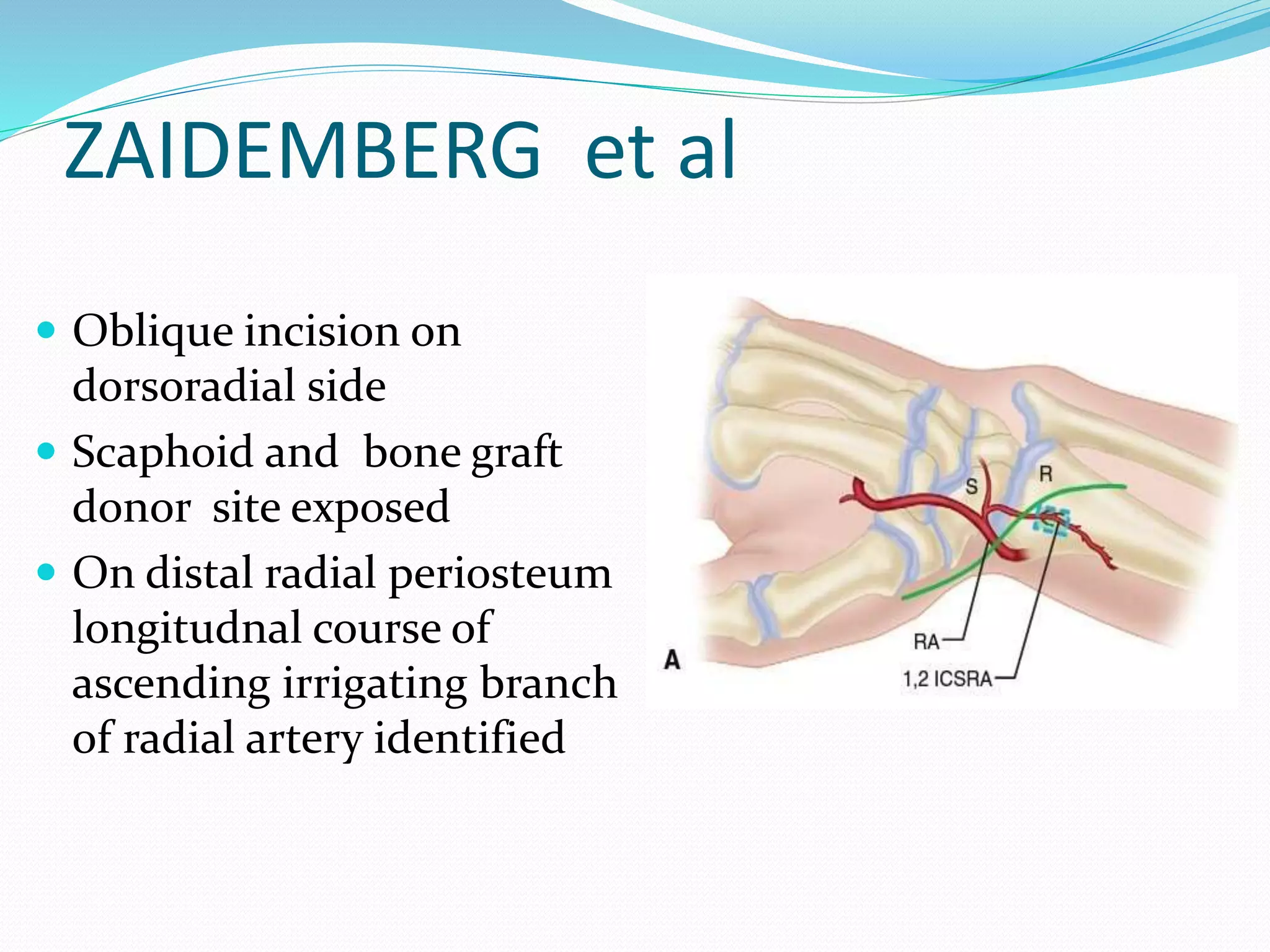 Avascular necrosis of scaphoid | PPTX