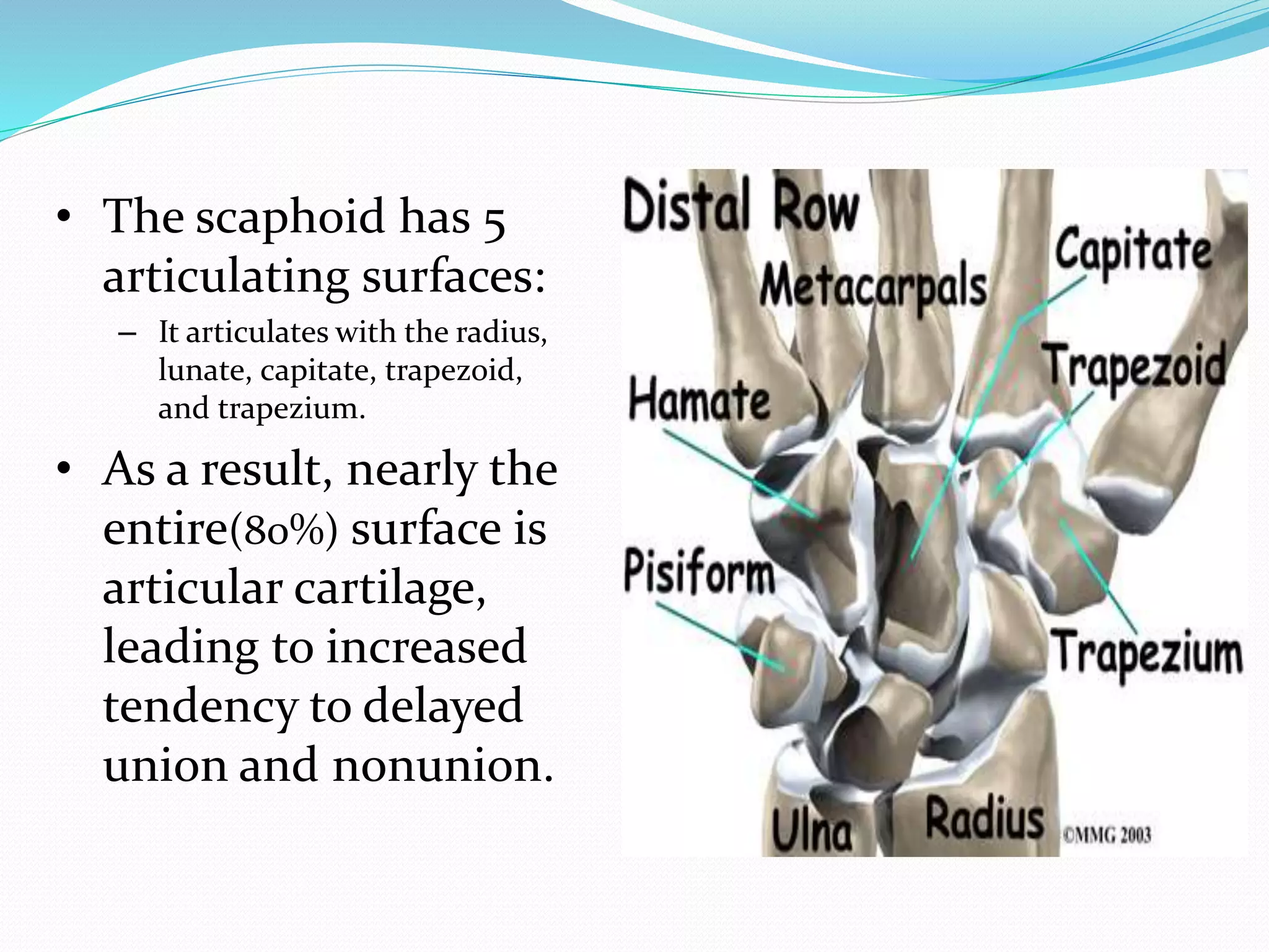 Avascular necrosis of scaphoid | PPTX