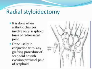 Avascular necrosis of scaphoid | PPT