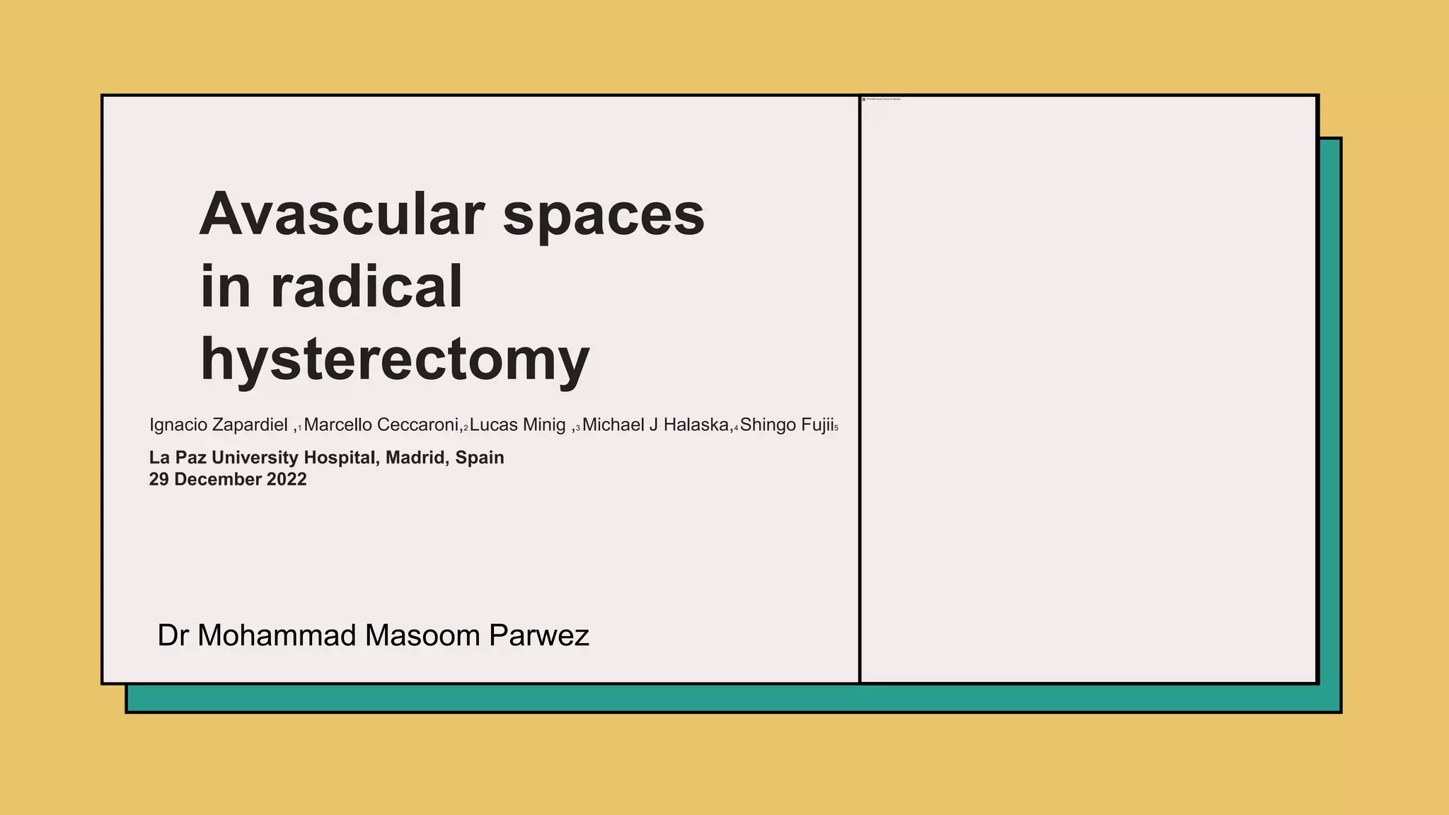 Avascular spaces in radical hysterectomy.pptx