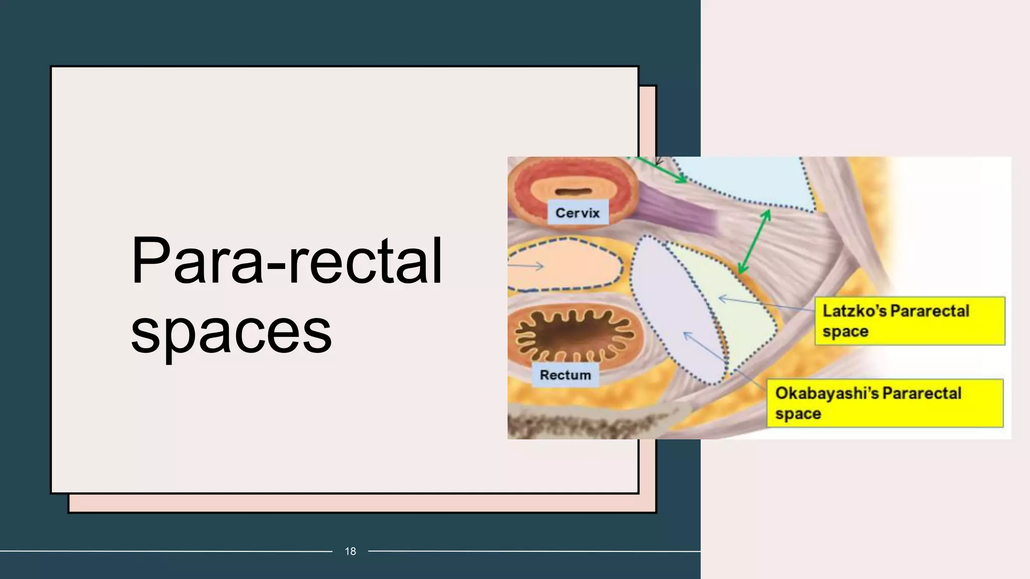 Avascular spaces in radical hysterectomy.pptx
