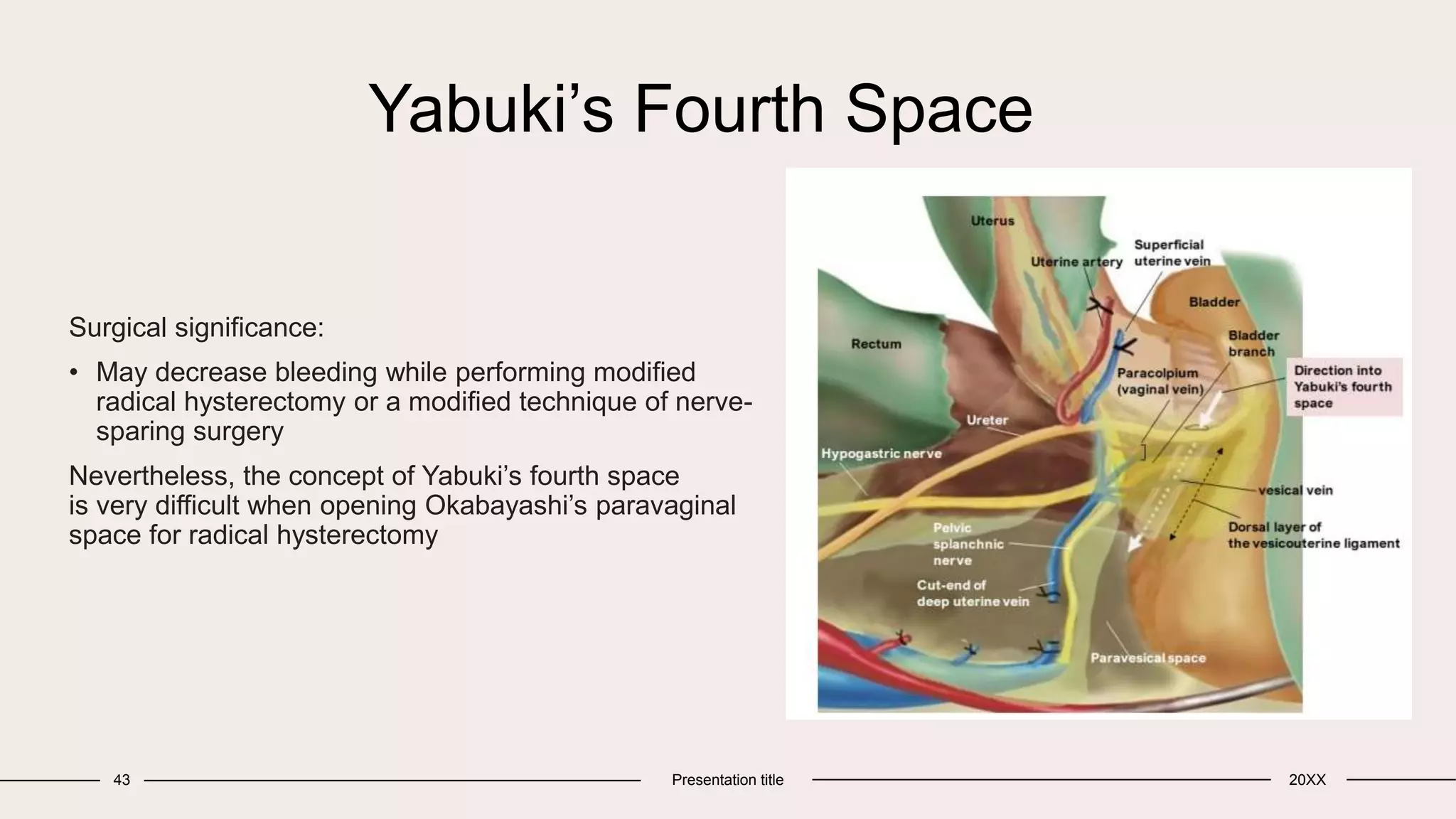 Avascular spaces in radical hysterectomy.pptx