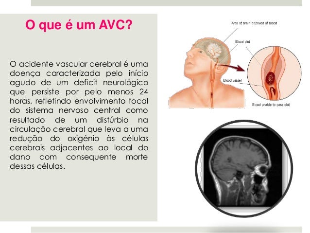 Avc.....