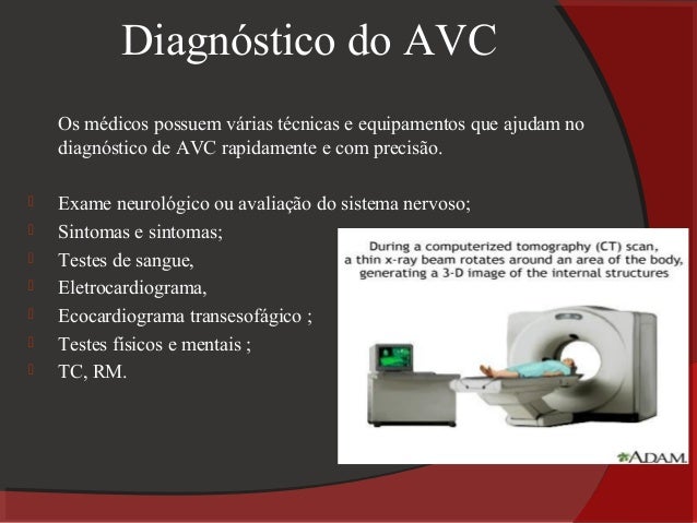 AVC