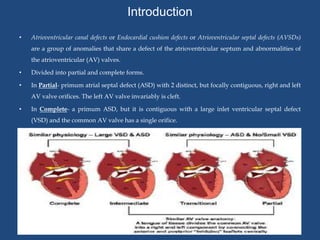 Partial Endocardial Cushion Defect
