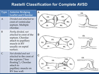 Av canal defect | PPT
