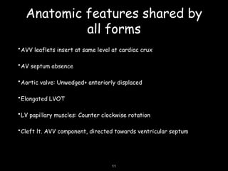 ATRIOVENTRICULAR SEPTAL DEFECT | PPTX