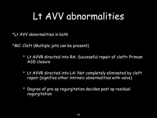 ATRIOVENTRICULAR SEPTAL DEFECT | PPTX
