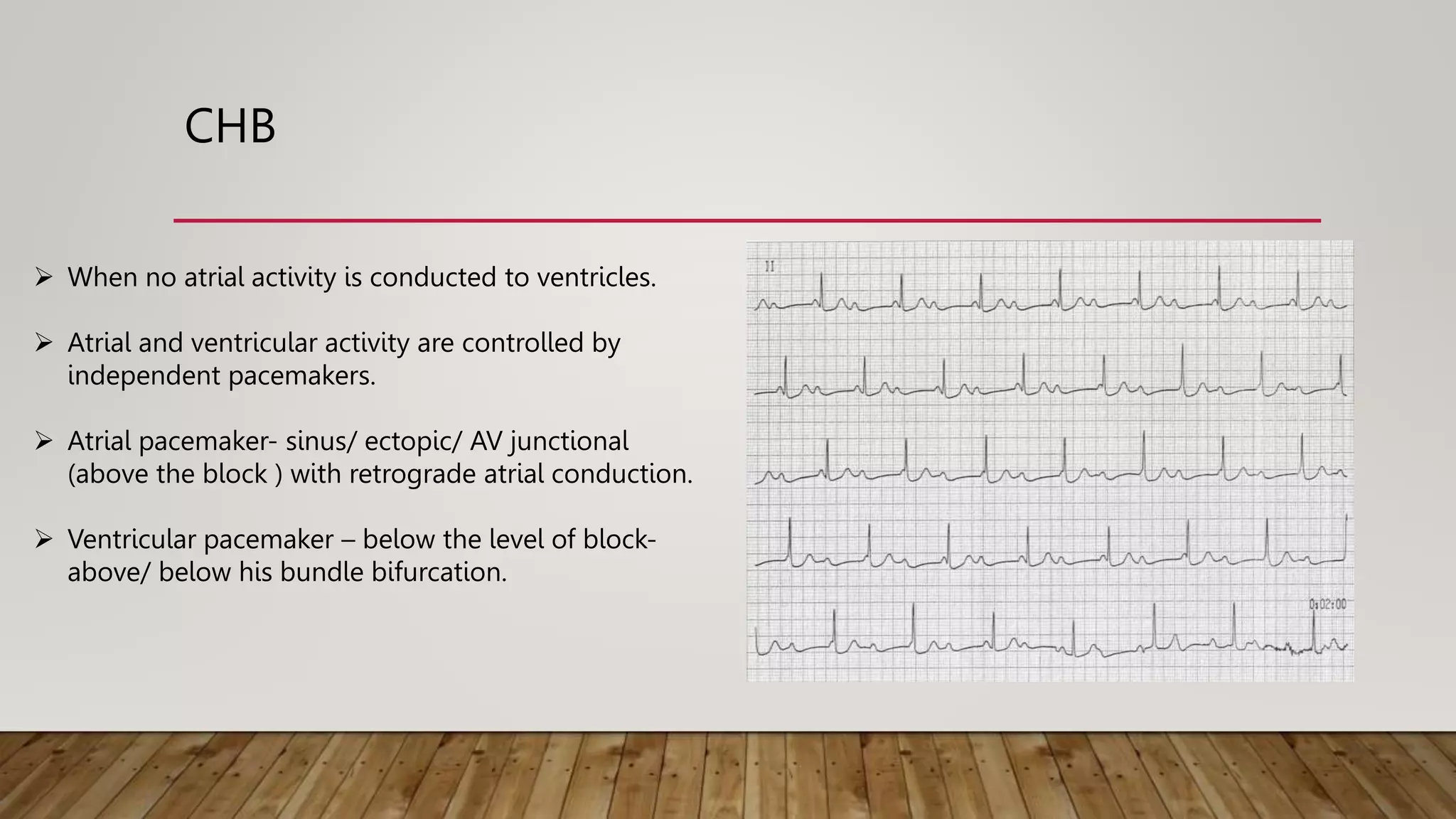 AV dissociation.pptx | Heart and Cardiovascular Diseases | Diseases and ...
