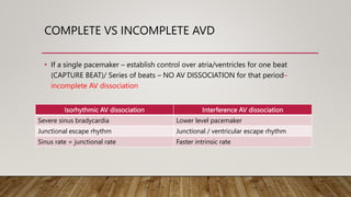 AV dissociation.pptx | Heart and Cardiovascular Diseases | Diseases and ...