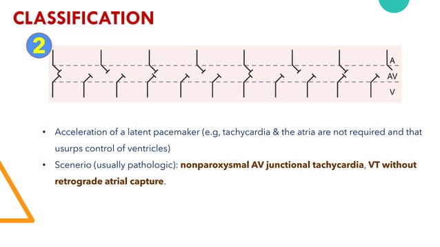 ATRIOVENTRICULAR DISSOCIATION - Phân li nhĩ thất | PPT