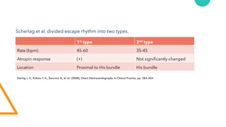 ATRIOVENTRICULAR DISSOCIATION - Phân li nhĩ thất | PDF