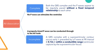 ATRIOVENTRICULAR DISSOCIATION - Phân li nhĩ thất | PPT
