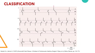 ATRIOVENTRICULAR DISSOCIATION - Phân li nhĩ thất | PDF