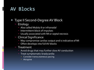 Av dysrhythmias | PPTX