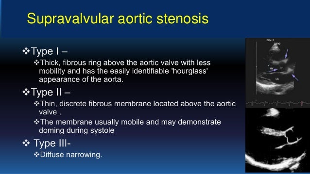 Echo assesment of Aortic Stenosis and Regurgitation